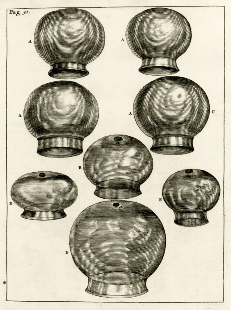 Verschiedene Schröpfgläser, aus Exercitationes Practicae circa Medendi ...